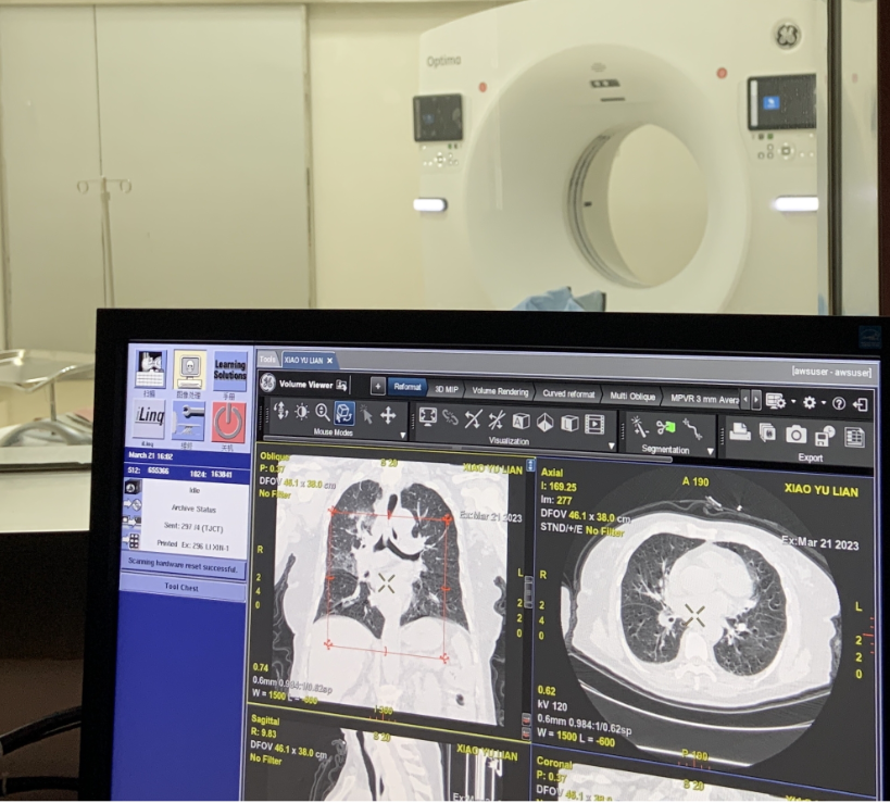 “肺常完美”--胸部CT检查该如何选择